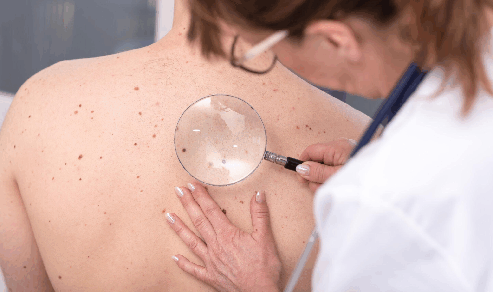 Risks Of Surgical Skin Cancer Treatment